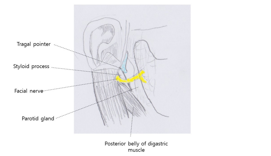 The importance of individualized and multiple landmarks for the ...
